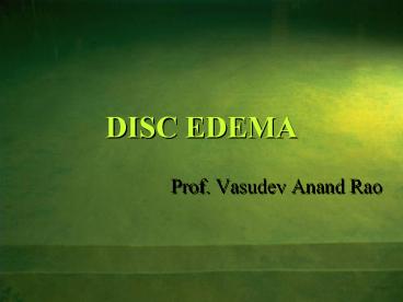 DISC EDEMA presentation | free to download