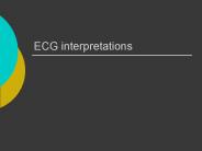 PPT – basics of ecg PowerPoint presentation | free to download - id ...