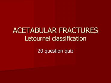ACETABULAR FRACTURES Letournel classification presentation | free to view