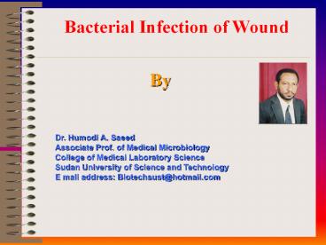 Bacterial Infection of Wound presentation | free to view