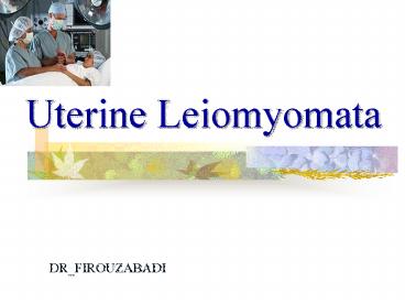 PPT – ?? ??? ????? ???? ??? Uterine Leiomyomata PowerPoint presentation ...