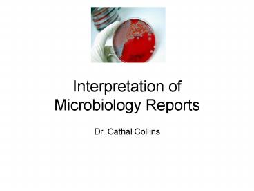 Interpretation of Microbiology Reports presentation | free to view