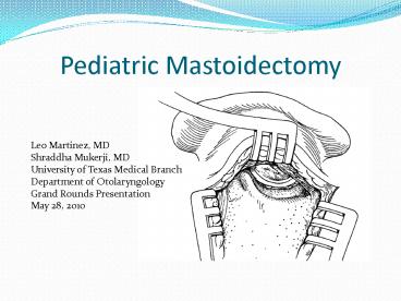 Pediatric Mastoidectomy presentation | free to view
