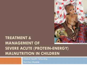 PPT – Treatment PowerPoint presentation | free to download - id: 468bce ...