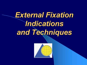 External Fixation Indications and Techniques presentation | free to view