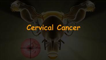 Cervical Cancer presentation | free to view
