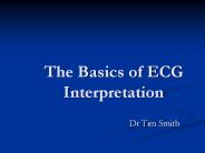 PPT – basics of ecg PowerPoint presentation | free to download - id ...