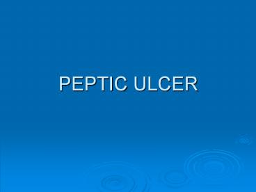 PPT – PEPTIC ULCER PowerPoint presentation | free to download - id: 48f68c-MWVhO