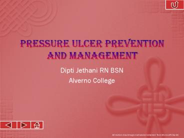 Pressure Ulcer Prevention and Management presentation | free to view