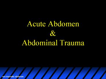 Acute Abdomen presentation | free to view