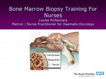 PPT – Bone Marrow Biopsy Training For Nurses Louise McNamara Matron ...