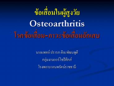 PPT – ???????????????????? Osteoarthritis ...
