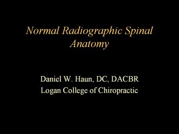 Normal Radiographic Spinal Anatomy presentation | free to download