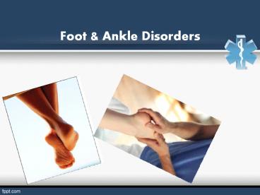 Foot & Ankle Disorders presentation | free to download