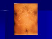 PPT – Limnic Eruptions PowerPoint presentation | free to view - id ...