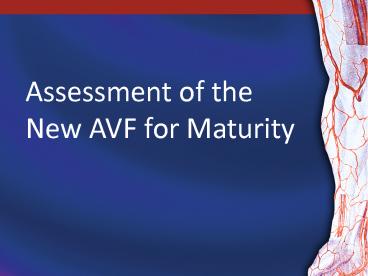 Assessment of the New AVF for Maturity presentation | free to download