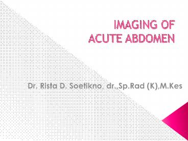 IMAGING OF ACUTE ABDOMEN presentation | free to download