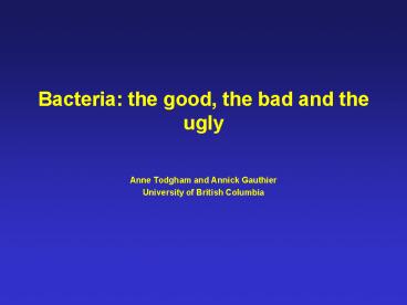Bacteria: the good, the bad and the ugly presentation | free to view