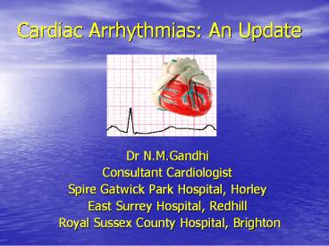 Cardiac Arrhythmias: An Update presentation | free to view