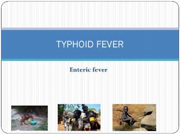 Enteric fever presentation | free to view