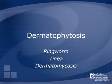Dermatophytosis presentation | free to download