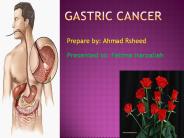PPT – GASTRIC CARCINOMA PowerPoint presentation | free to download - id ...