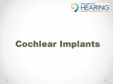 Cochlear Implants presentation | free to download