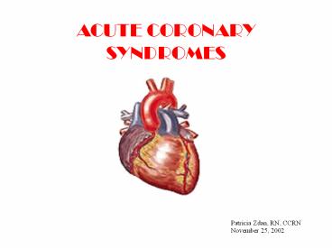 PPT – ACUTE CORONARY SYNDROMES PowerPoint presentation | free to ...