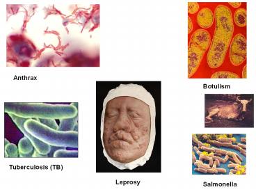 PPT – Botulism PowerPoint presentation | free to download - id: 6c48b4 ...
