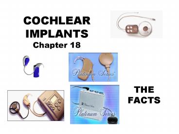 PPT – COCHLEAR IMPLANTS Chapter 18 PowerPoint presentation | free to ...