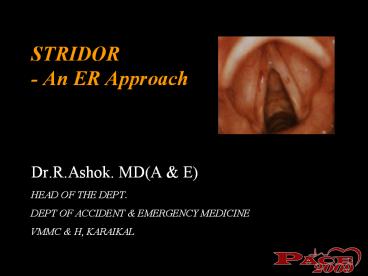 STRIDOR - An ER Approach presentation | free to download