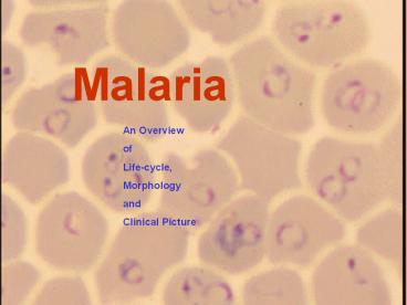PPT – Malaria PowerPoint presentation | free to view - id: 743eb5-M2U5N