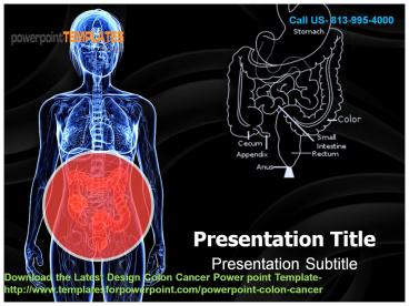 PPT – Latest Design Colon Cancer Power point Template PowerPoint ...