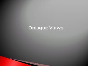 PPT – Oblique Views PowerPoint presentation | free to view - id: 763023 ...