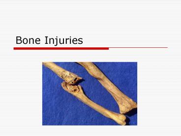 PPT – Bone Injuries PowerPoint presentation | free to view - id: 76664f ...