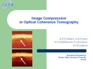 PPT – Optical Coherence Tomography PowerPoint presentation | free to ...