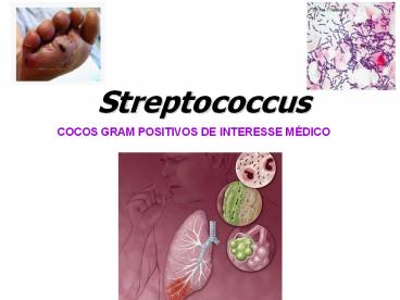 Streptococcus presentation | free to view