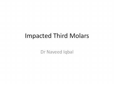 PPT – impacted third molars PowerPoint presentation | free to download ...