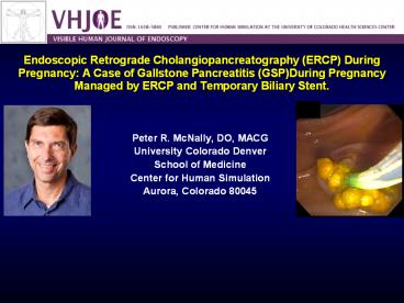 Endoscopic Retrograde Cholangiopancreatography (ERCP) During Pregnancy ...