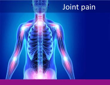Joint pain presentation | free to download