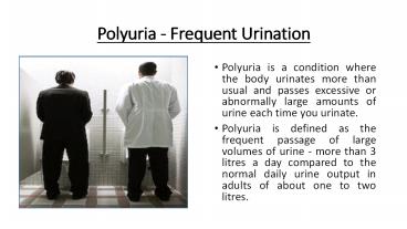 Polyuria - Frequent Urination presentation | free to download
