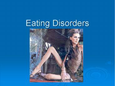 PPT – Eating Disorders PowerPoint presentation | free to download - id ...