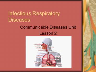 PPT – Infectious Respiratory Diseases PowerPoint presentation | free to ...