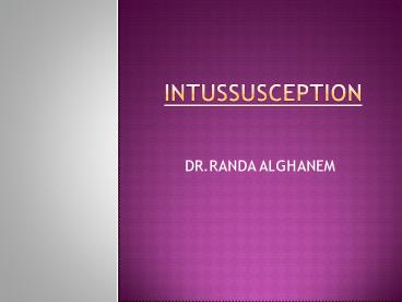 INTUSSUSCEPTION presentation | free to view