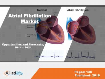 PPT – Atrial Fibrillation Device Market - Global Industry Analysis ...