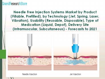 PPT – Needle Free Injection Systems Market by Technology Type of ...