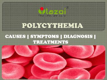 Polycythemia: Causes, symptoms, diagnosis and treatment presentation ...