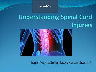 Understanding Spinal Cord Injuries presentation | free to download