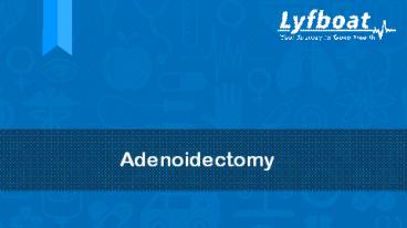 Adenoidectomy presentation | free to download