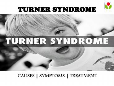 Turner syndrome : causes, symptoms and treatment presentation | free to ...